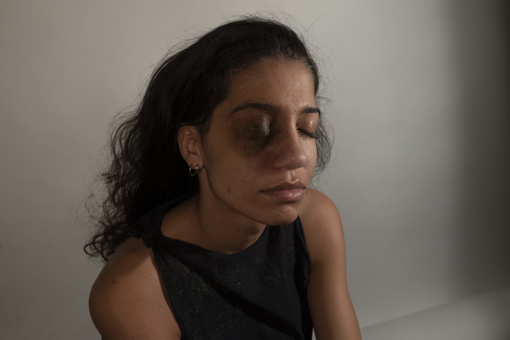 Punched Eye T1 Silicone Prosthetic – The Compleat Sculptor, Inc